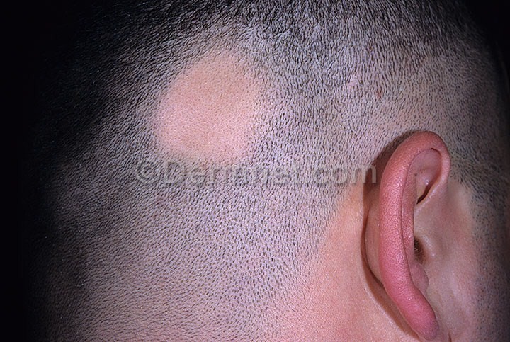 Case 3 - Q4 Explanation - Alberta Dermatology